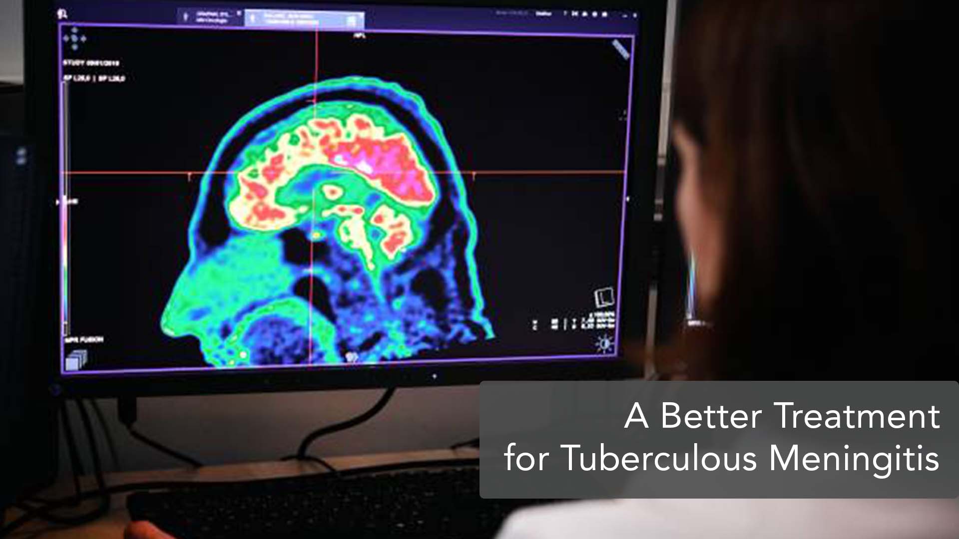 Higher-Dose Oral Rifampin Reduces the Mortality Rate of Patients with ...