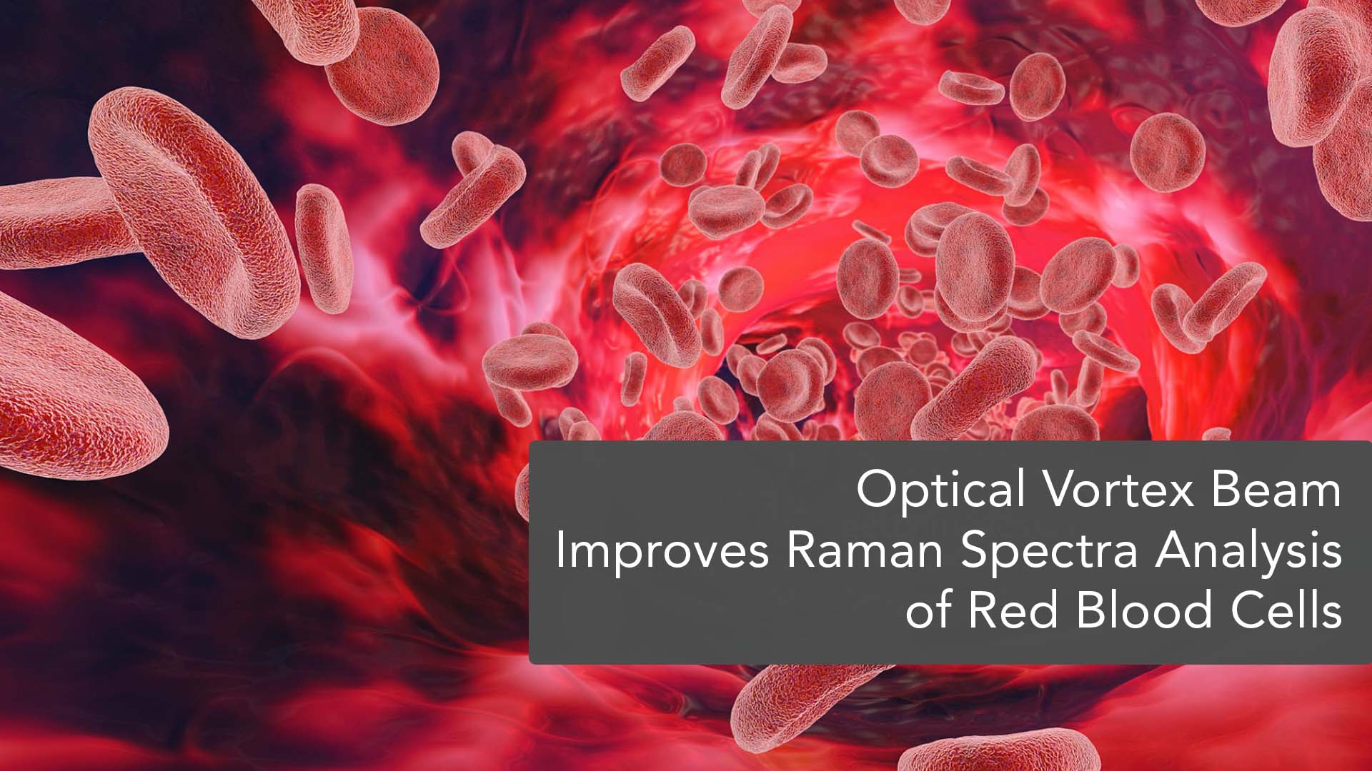 Novel Raman Spectroscopy Approach for Competent Cell Membrane Studies ...