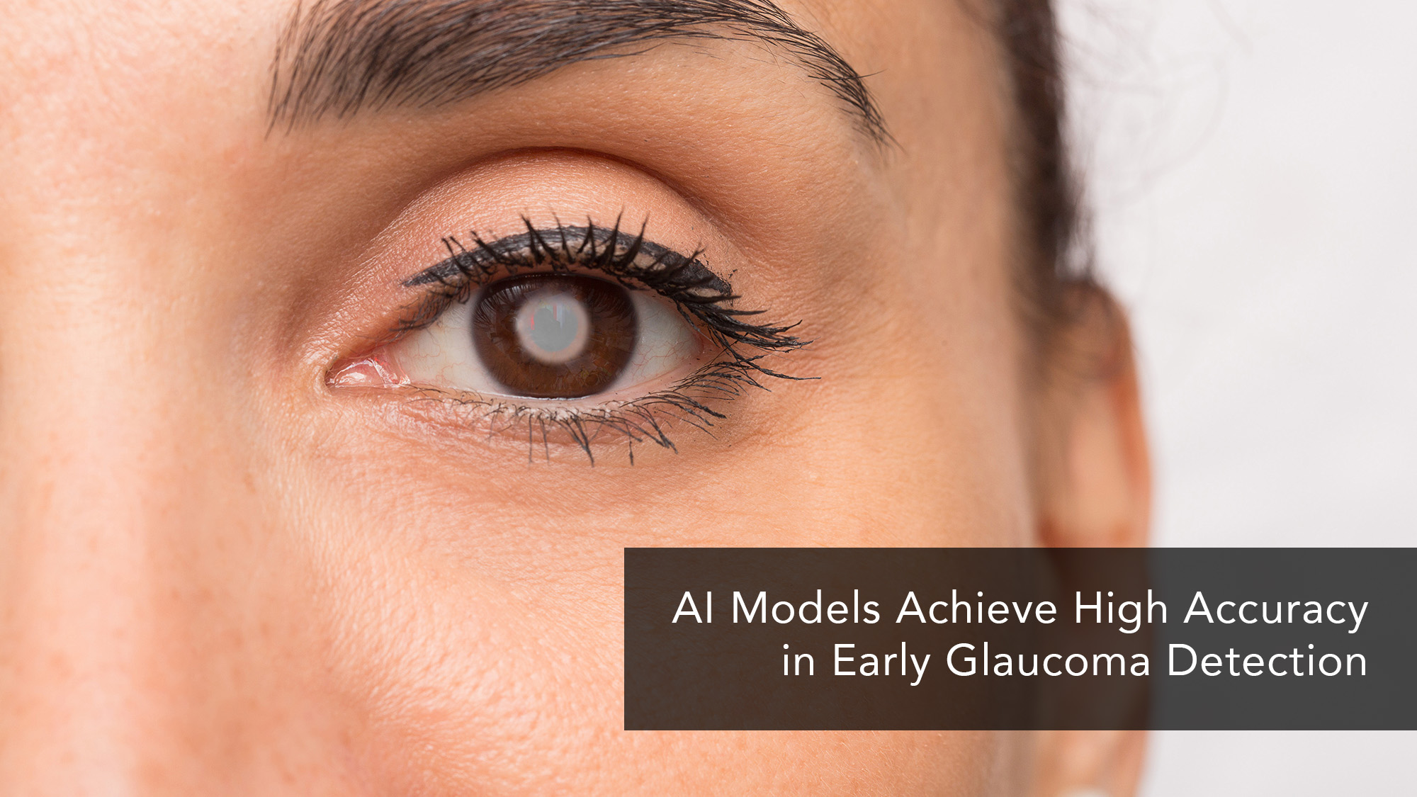 A Deep-learning System Predicts Glaucoma Incidence and Progression ...