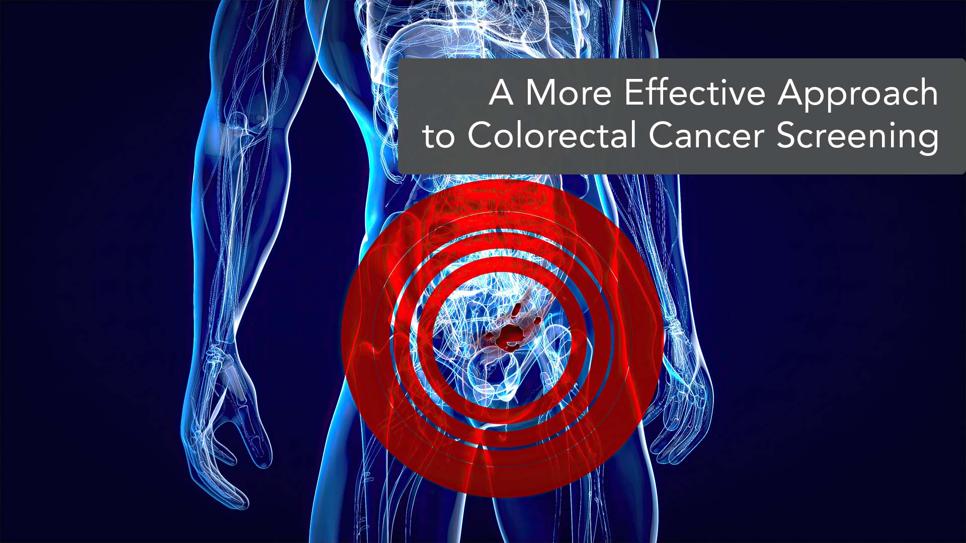 Tailored Screening for Colorectal Cancer: Enhancing Early Detection ...
